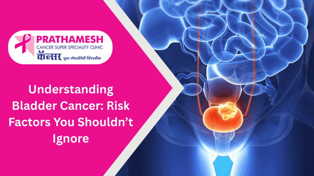 Understanding Bladder Cancer: Risk Factors You Shouldn’t Ignore - Dr ...